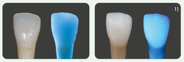Visalys® BioCeramic Block | Kettenbach Dental